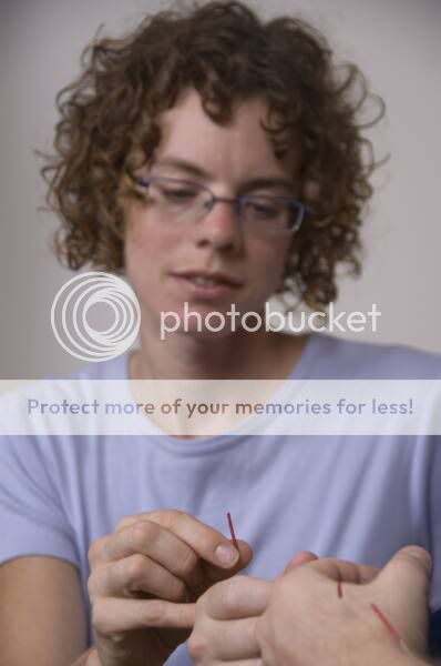 The Beautiful Baby Point- Accupuncture for a Healthy Baby | The ...